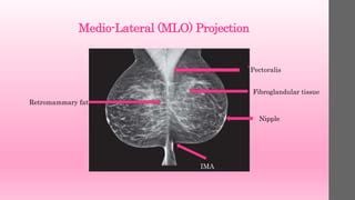 Mammography Positioning Technique For Mlo View Pptx