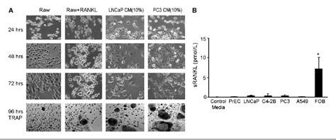 Figure 1 From Monocyte Chemotactic Protein 1 Mediates Prostate Cancer