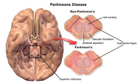 The Basal Nuclei Introduction To Neuroscience