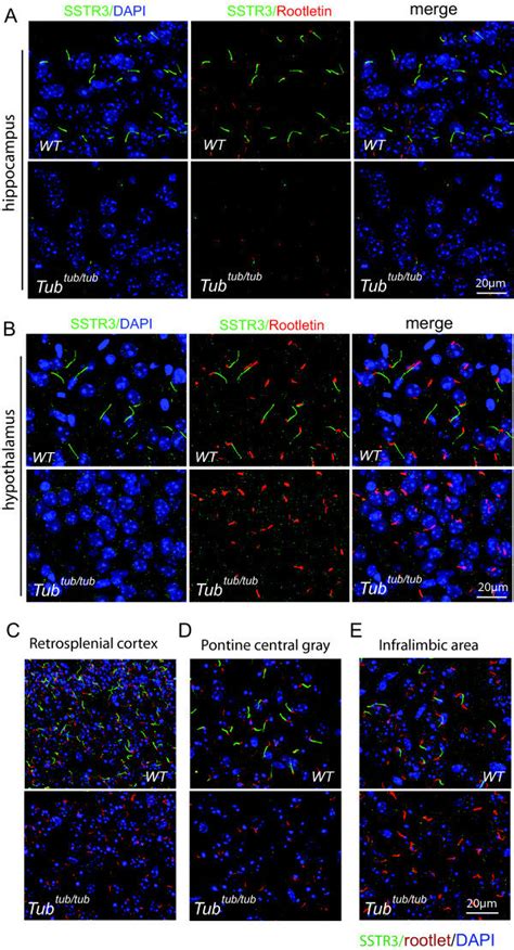Defective Ciliary Targeting Of Sstr3 In The Tubby Mutant In Both