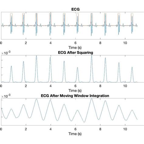 The Filtering Process Of Sleep Ecg Signal Download Scientific Diagram