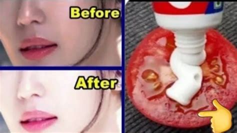 Toothpaste For Face Whitening Tomato End Colgate Youtube