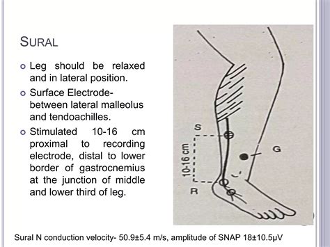 Nerve Conduction Studies Lower Leg Pptx
