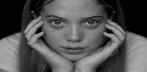 Dishidroza Cauze Simptome Tratament Sfaturimedicale Ro