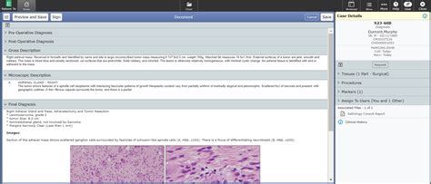 Expanse Pathology Meditech
