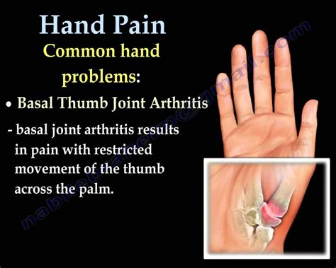 Discover 15 Wrist And Hand Exercises And Hand Exercises Ideas Hand