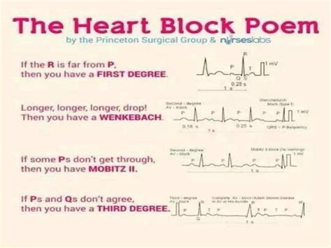 Heart Block Pptx