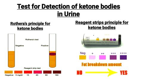 What Causes Trace Amounts Of Ketones In Urine At Ruth Madison Blog