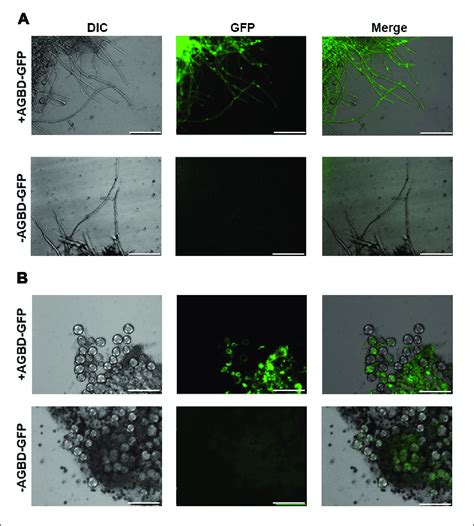 Fluorescence Microscopy Of The Bpu1 Strain Stained With Download