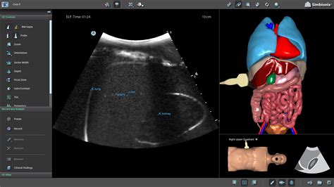 Echofirst Formation Déchographie Clinique Pour Toutes Les Spécialités