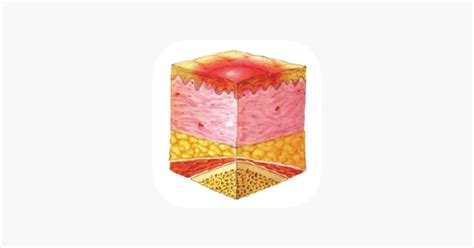 ‎bcg Pressure Ulcer Guide On The App Store
