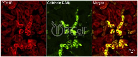 Calbindin 1 Calb1 Or Calbindin D 28k Antibody Bicell Scientific®