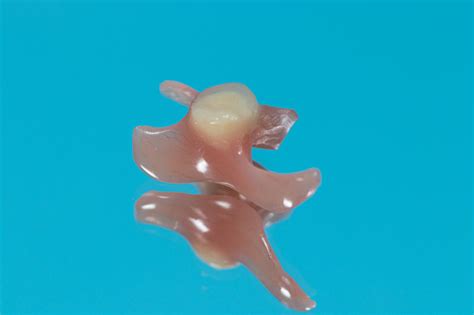 Artificial Tooth Prosthesis In On A Blue Background Single Removable Prosthesis To Replace A
