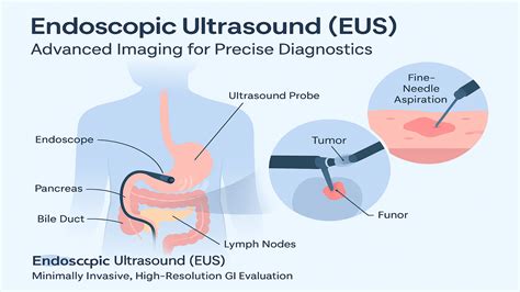 Endoscopic Ultrasound Eus In Coimbatore Gi Diagnosis
