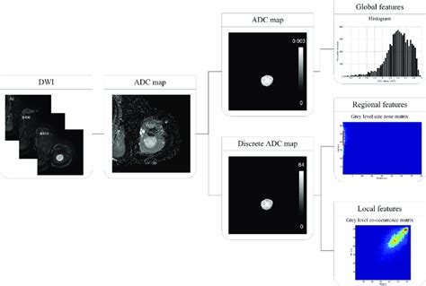 Flow Chart For Texture Analysis Of Dwi In Myxoid Containing Stts For