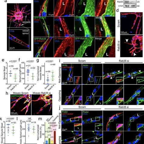 Rab35 Is An Apical Membrane Protein Required For Sprout Formation A