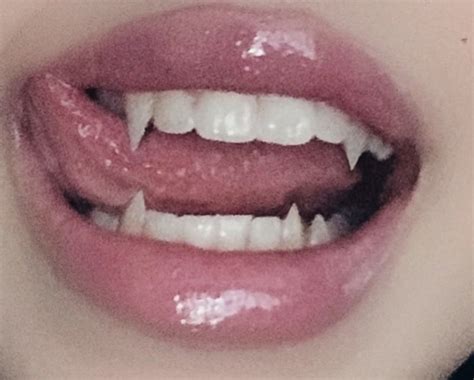 D I Y Vampire Fangs Works With Braces Artofit