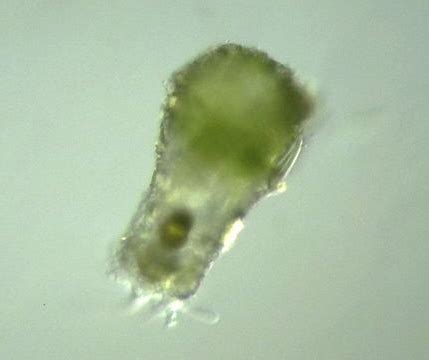 Protist Images Difflugia Oblonga