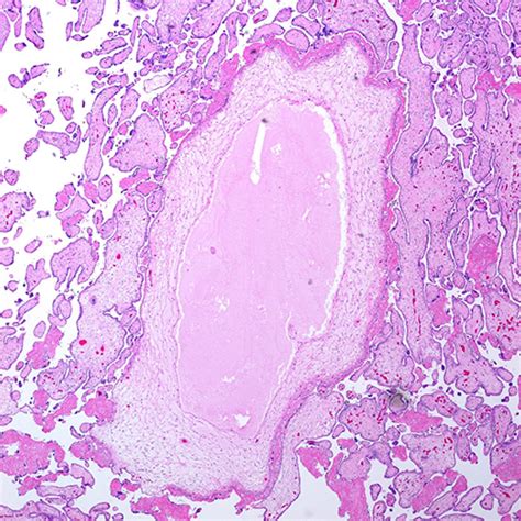 September 2019 Case Cedars Sinai