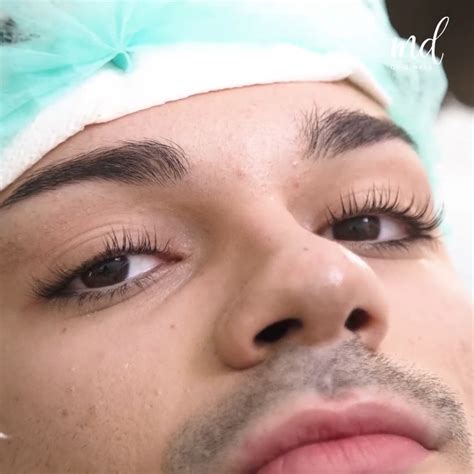 Lash Lifting Tutorial Artofit