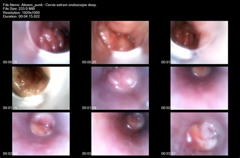 Xtreme Pussy Fistingobject Insertion Videos Page 203