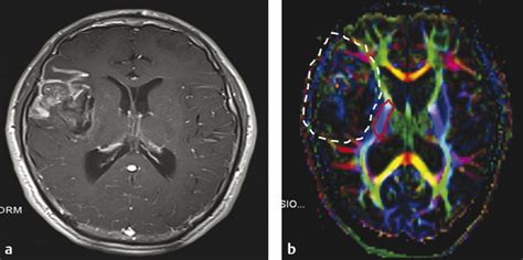 3 Going Beyond The Conventional Morphological Imaging An Overview Of