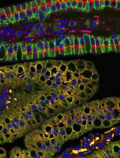 Scientists Uncover The Hidden Role Of Mitochondria In Dietary Fat