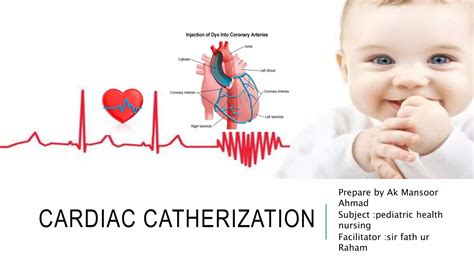 Cardiac Catherization Pptx