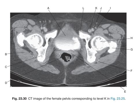 Ct Pelvis Axial Female Anatomy Quiz