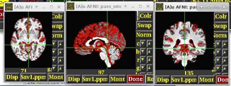 FMRI Preprocessing On Older Adults AFNI Message Board AFNI Discuss Message Board