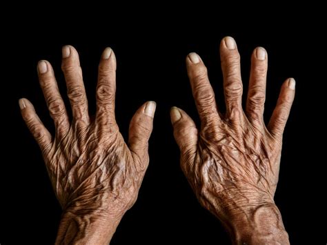 Does Gene Therapy Provide An Answer To Ageing The Independent