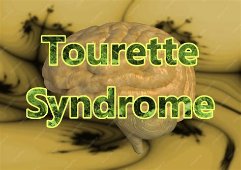 Syndrome De Gilles De La Tourette Neurologie Xntt