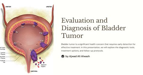 Evaluation And Diagnosis Of Bladder Tumor