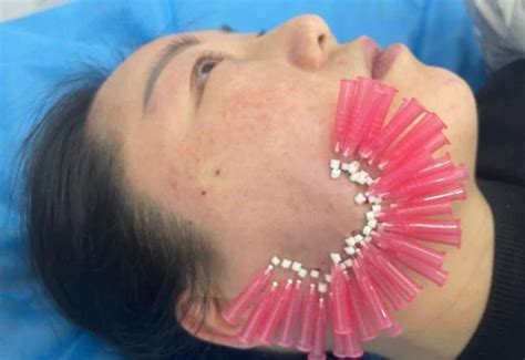 What Is The Difference Between Mono Threads Vs Pdo Threads Diaminyaesthetics