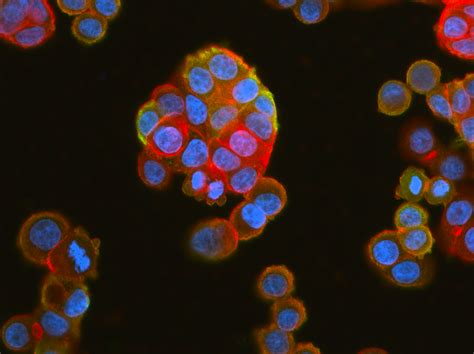 Widefield Fluorescence Microscopy Gallery Center For Microscopy And