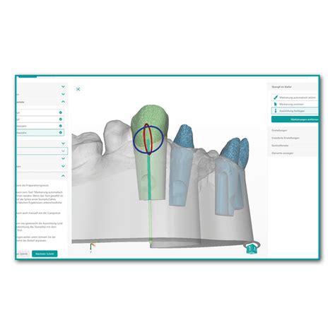 Sheraeasy Model Shera Werkstoff Technologie Gmbh