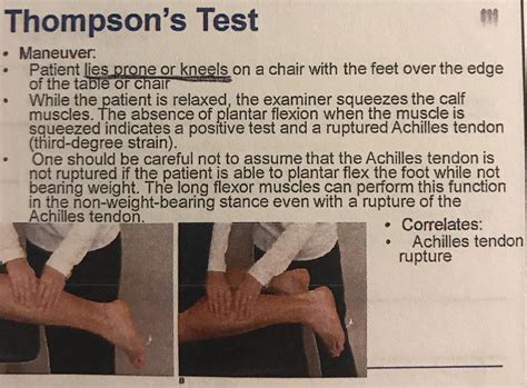 Thompsons Test