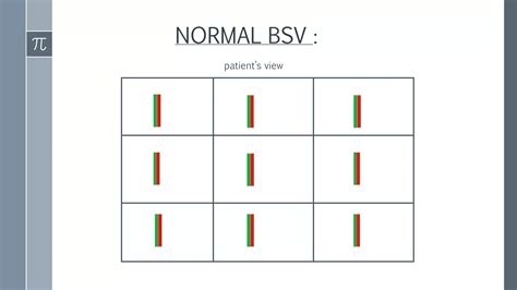 Diplopia Charting Pptx