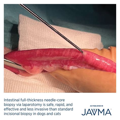Needle Core Biopsy Was Safe Rapid And Effective And Was Less Invasive