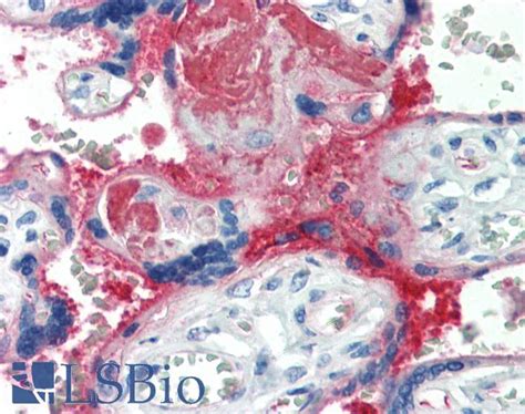 Ihc Plus™ Complement C4d Polyclonal Antibody Rabbit Anti Human Lsbio