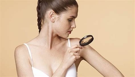 A Practical On When To See The Derm Doc