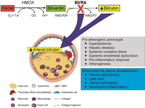 Atherosclerosis Plaque