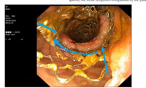 Japanese Journal Of Gastroenterology And Hepatology