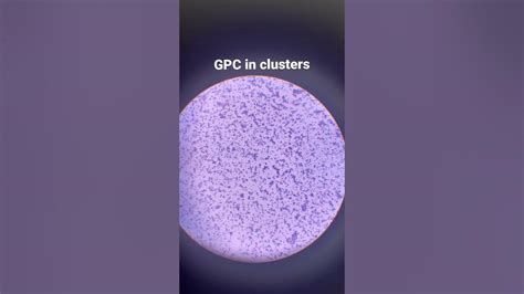 Gpc In Clusters Microbiology Microscope Gramstaining Youtube