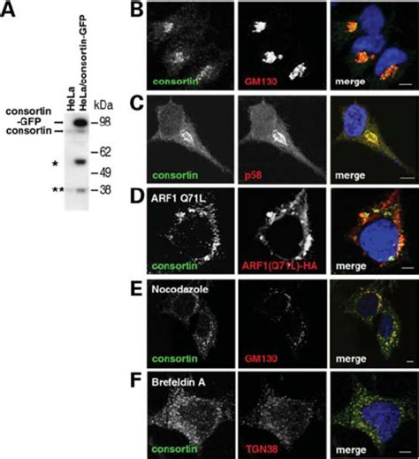 Subcellular Localization Of Consortin In The Golgi Apparatus A
