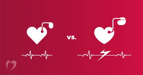 Pacemaker Or Defibrillator Whats The Difference Oklahoma Heart Hospital
