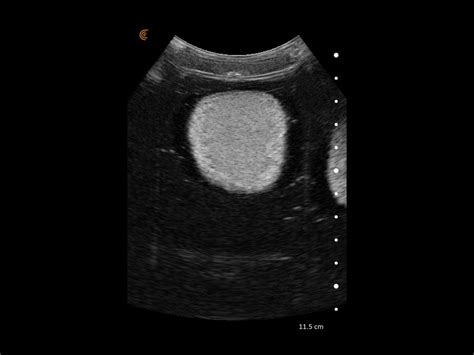 Phantom Object Det Object Detection Dataset By Prostate Ultrasound