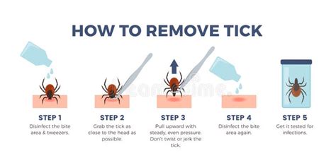 How To Remove Tick Stock Illustrations 27 How To Remove Tick Stock