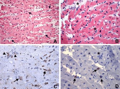 Histology And Immunohistochemistry Findings In Patients With