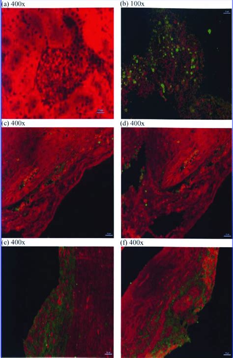 Immunofluorescence Detection Of Antigen Immune Complexes In The